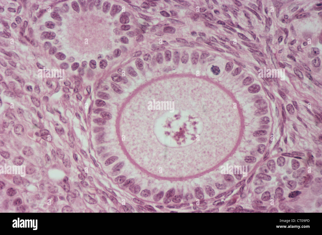 Ovary micrograph Banque de photographies et d’images à haute résolution ...