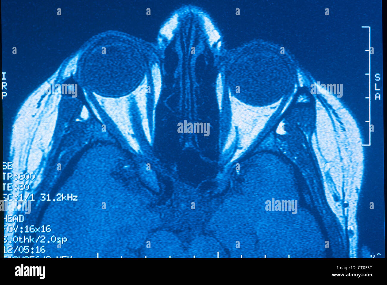Sinus scan Banque de photographies et d’images à haute résolution - Alamy