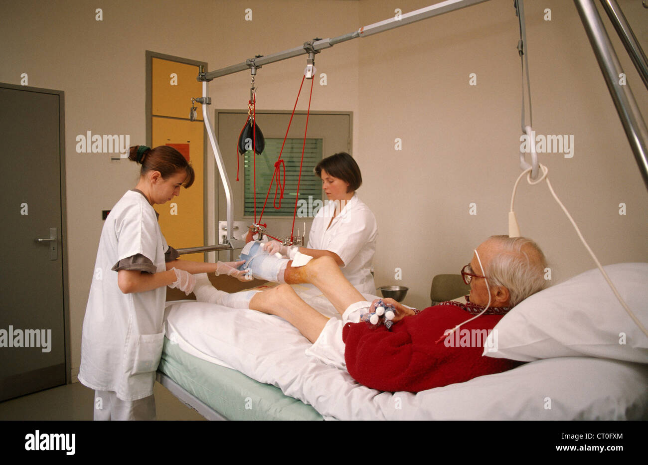 Ulcère de jambe variqueux Banque de photographies et d’images à haute ...