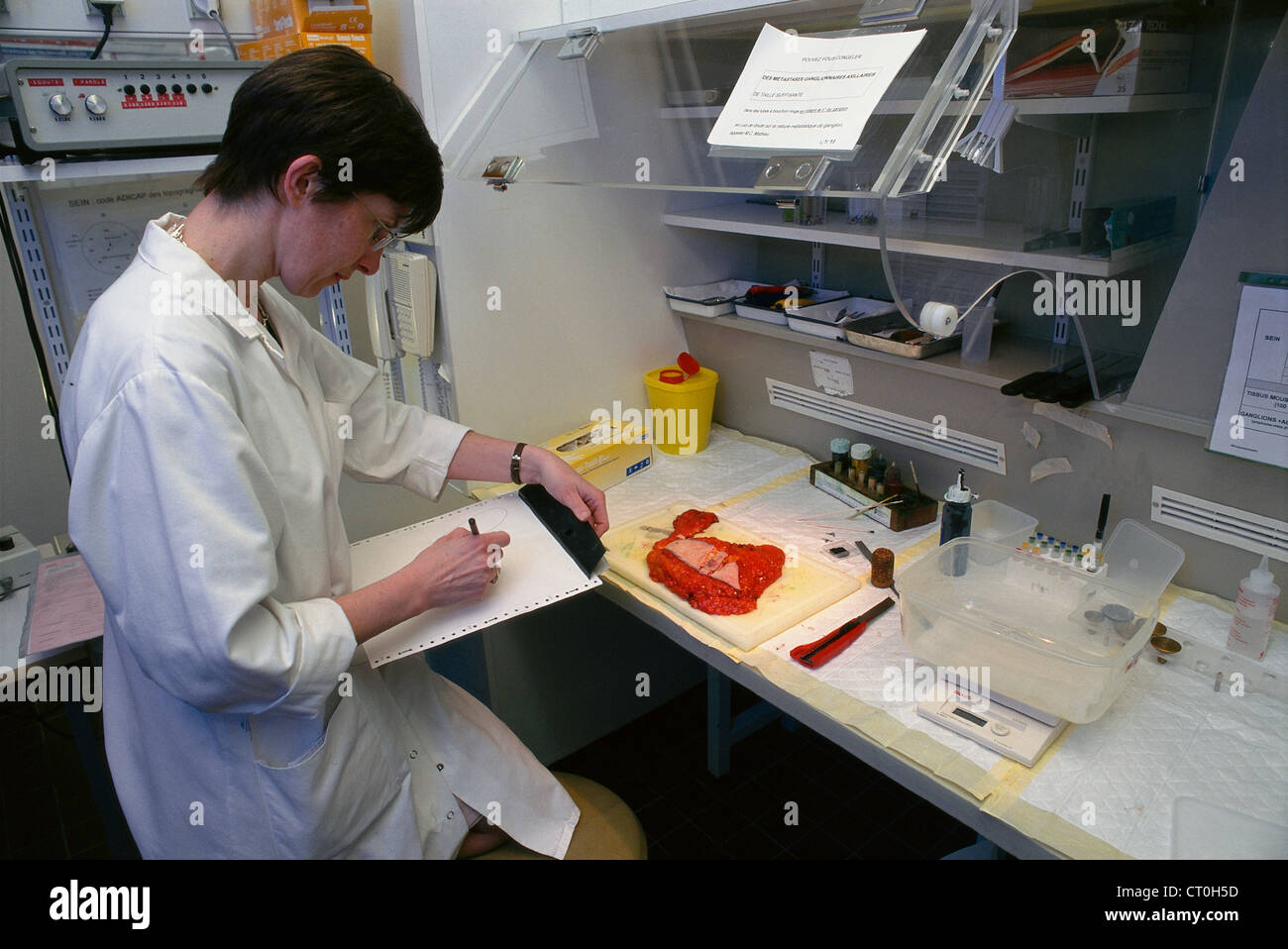Anatomopathology biopsy Banque de photographies et d’images à haute ...