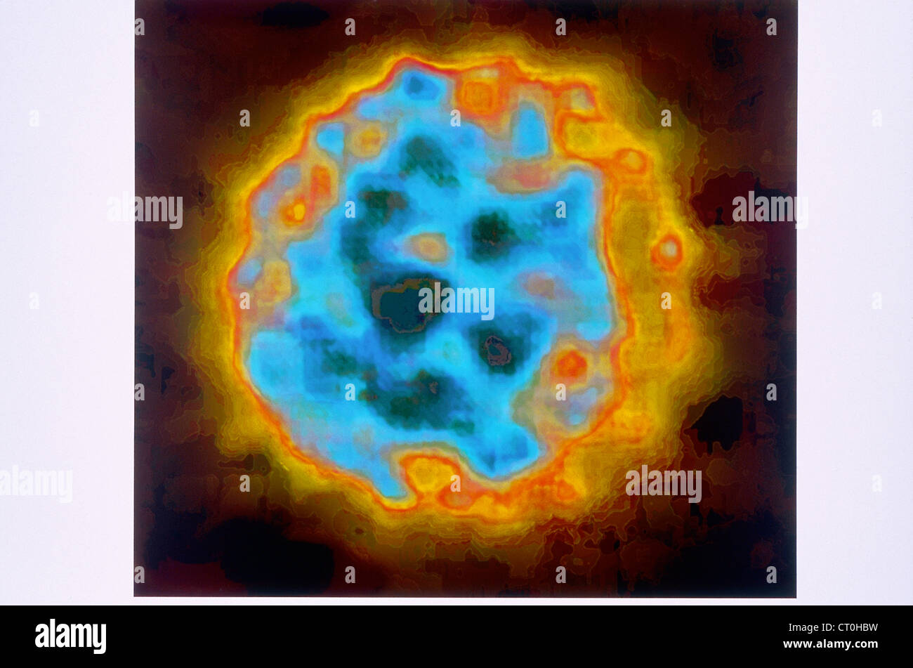 Virus du papillome humain Banque de photographies et d’images à haute ...