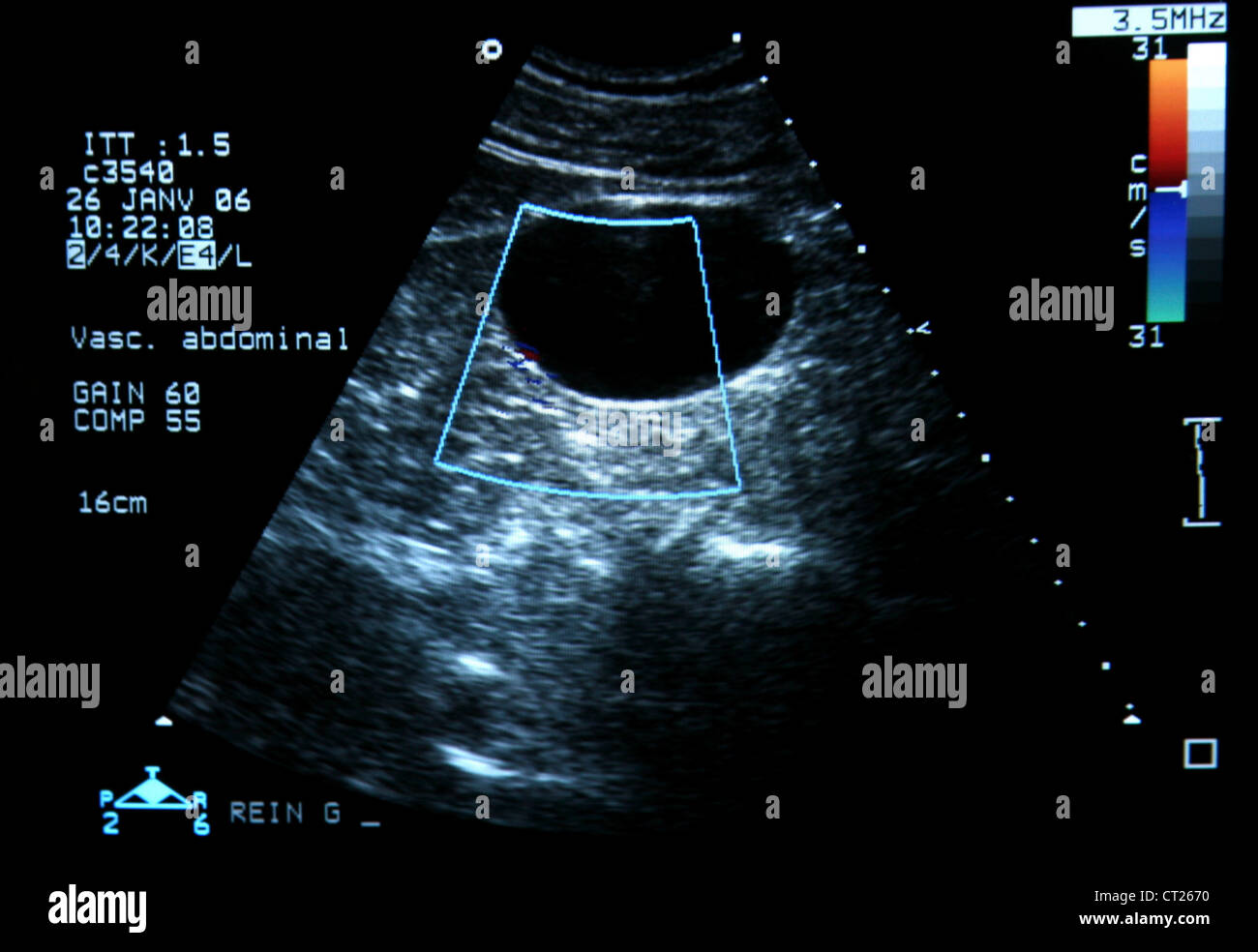 Kyste rein Banque de photographies et d’images à haute résolution - Alamy