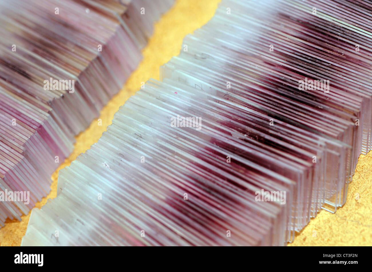 Une gamme de lames de microscope sur le point d'être examiné pour des ...