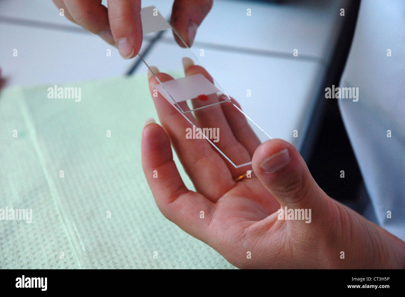 Frottis sanguin micrographie Banque de photographies et d’images à ...