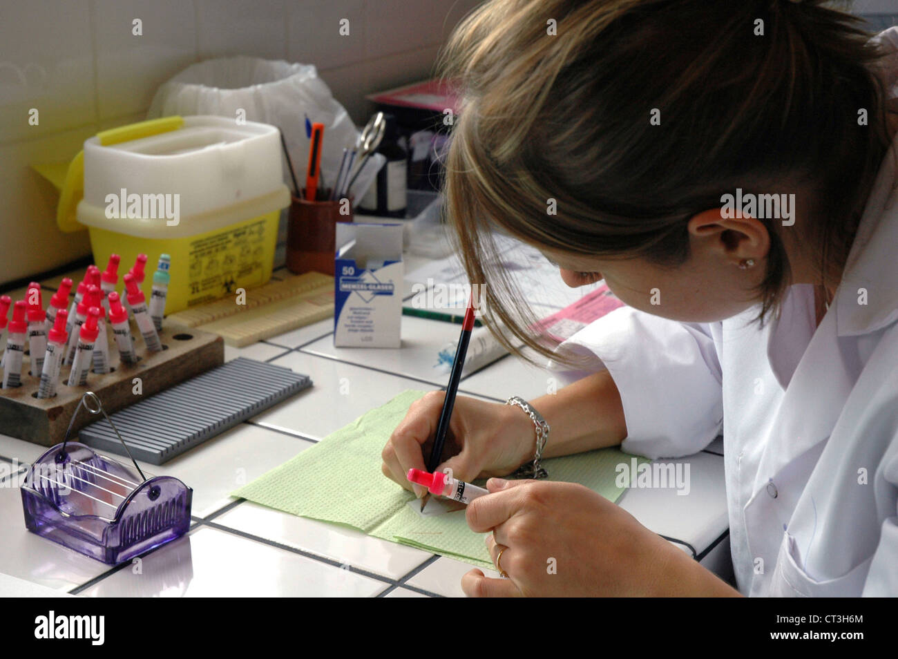 Frottis sanguin humain Banque de photographies et d’images à haute ...