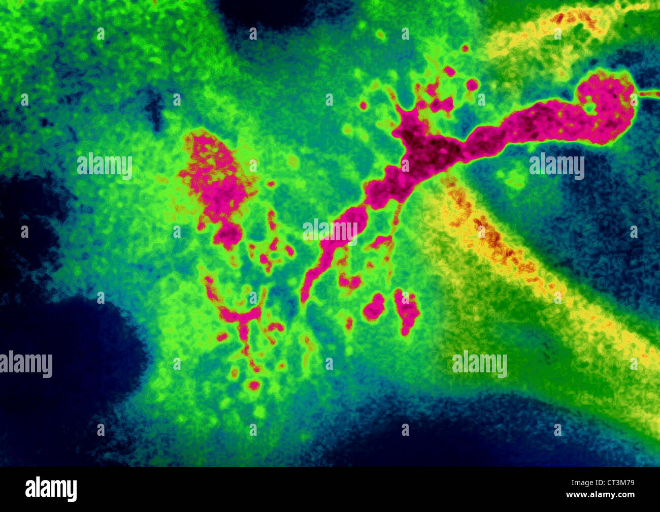 Parotid salivary glands Banque de photographies et d’images à haute ...