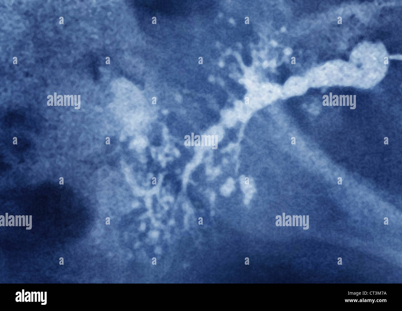 Parotid salivary glands Banque de photographies et d’images à haute ...