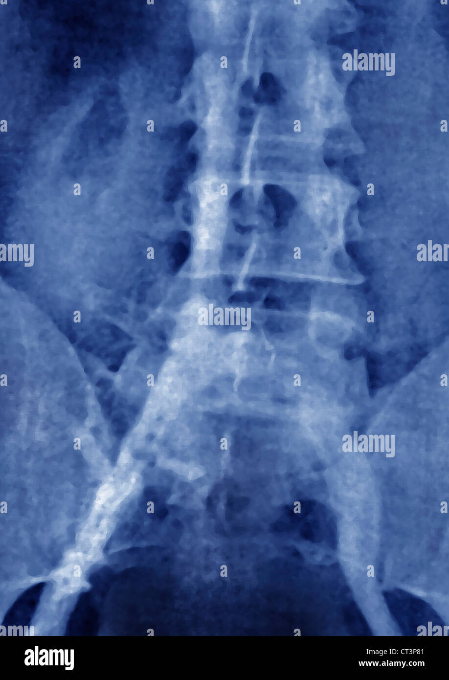 Vascularisation veineuse Banque de photographies et d’images à haute ...