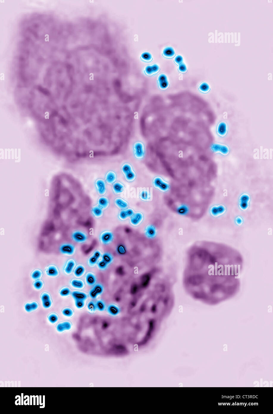 Neisseria gonorrhoeae Banque de photographies et d’images à haute ...