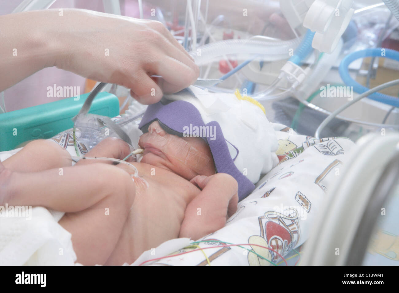 L'ictère néonatal, photothérapie Photo Stock - Alamy