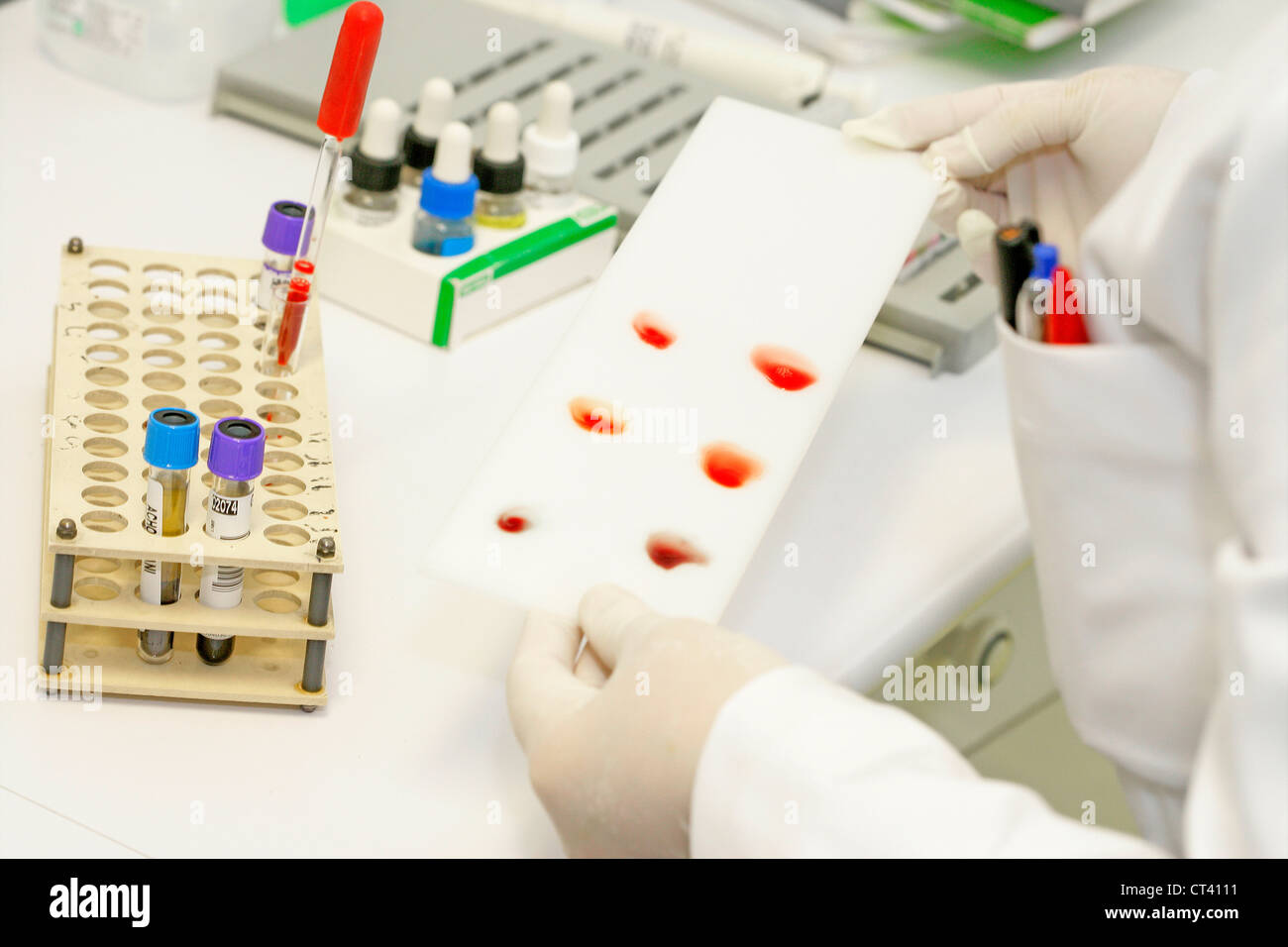 Tests immunologiques Banque de photographies et d’images à haute ...