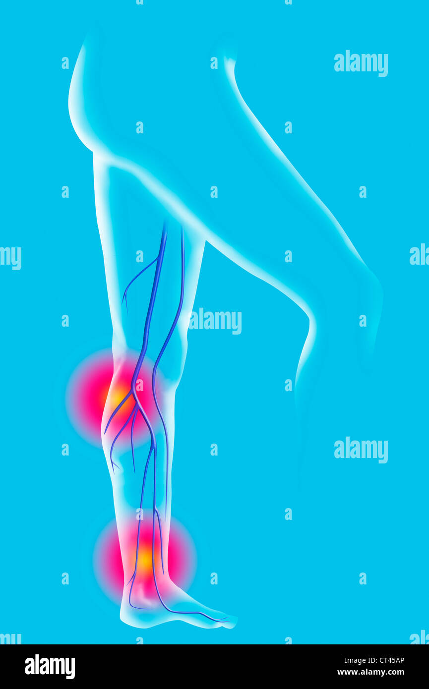Veine saphène externe Banque de photographies et d’images à haute ...