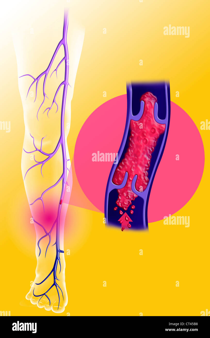 Vaisseaux sanguins de la jambe Banque de photographies et d’images à ...