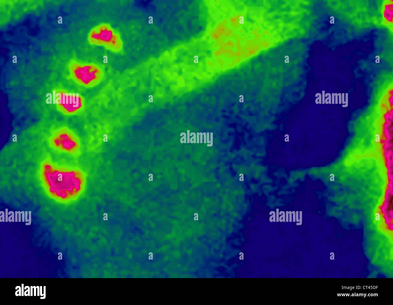 Ductus choledochus Banque de photographies et d’images à haute ...