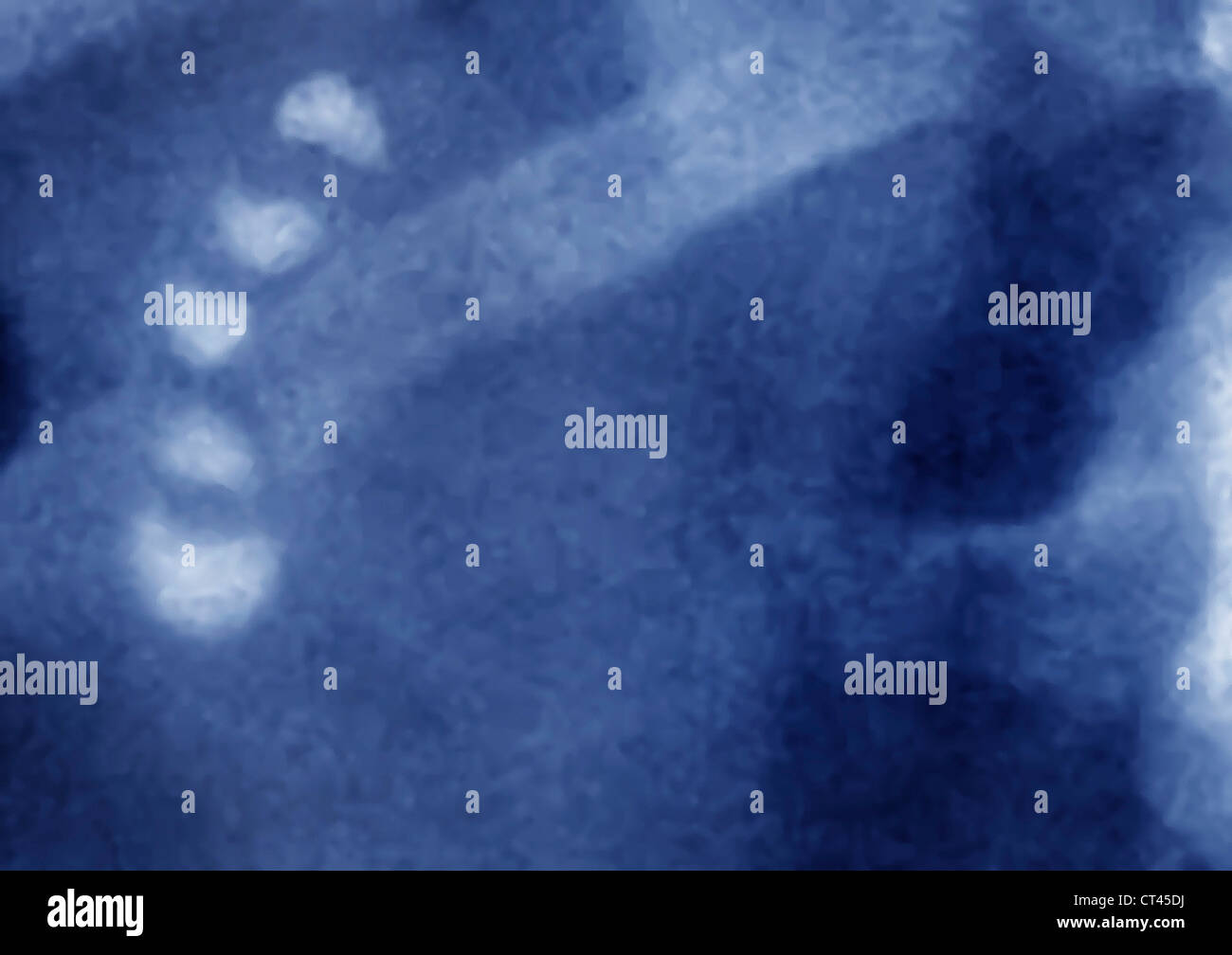 Canal cholédoque Banque de photographies et d’images à haute résolution ...