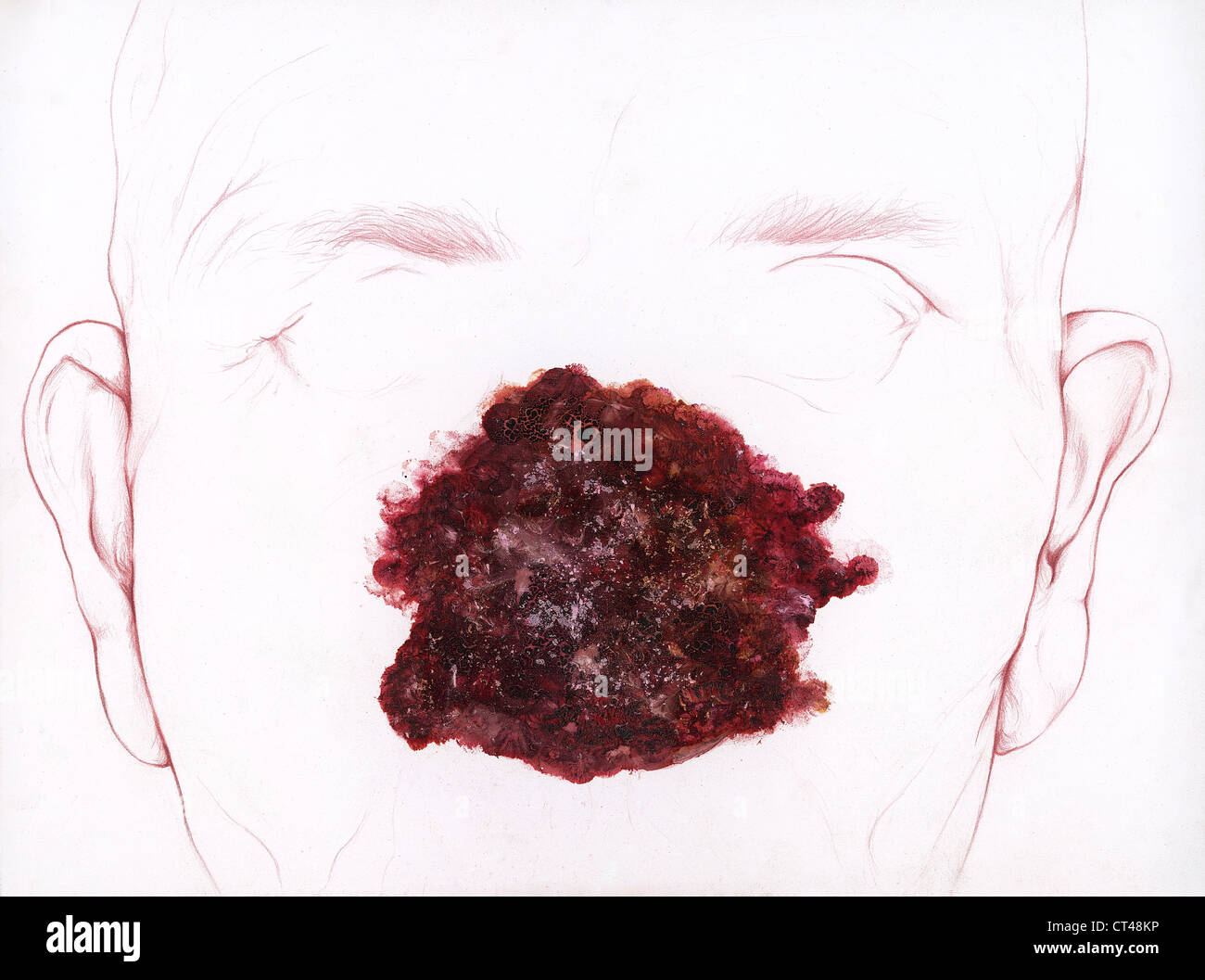 Cancer de la peau,carcinome nez Banque de photographies et d’images à haute résolution - Alamy