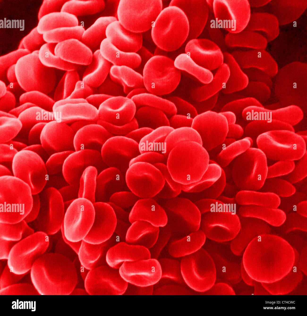 Globules rouges microscope Banque de photographies et d’images à haute ...