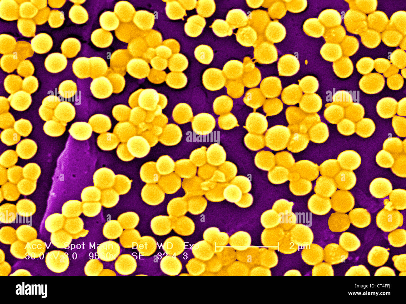 Staphylocoque doré Banque de photographies et d’images à haute ...