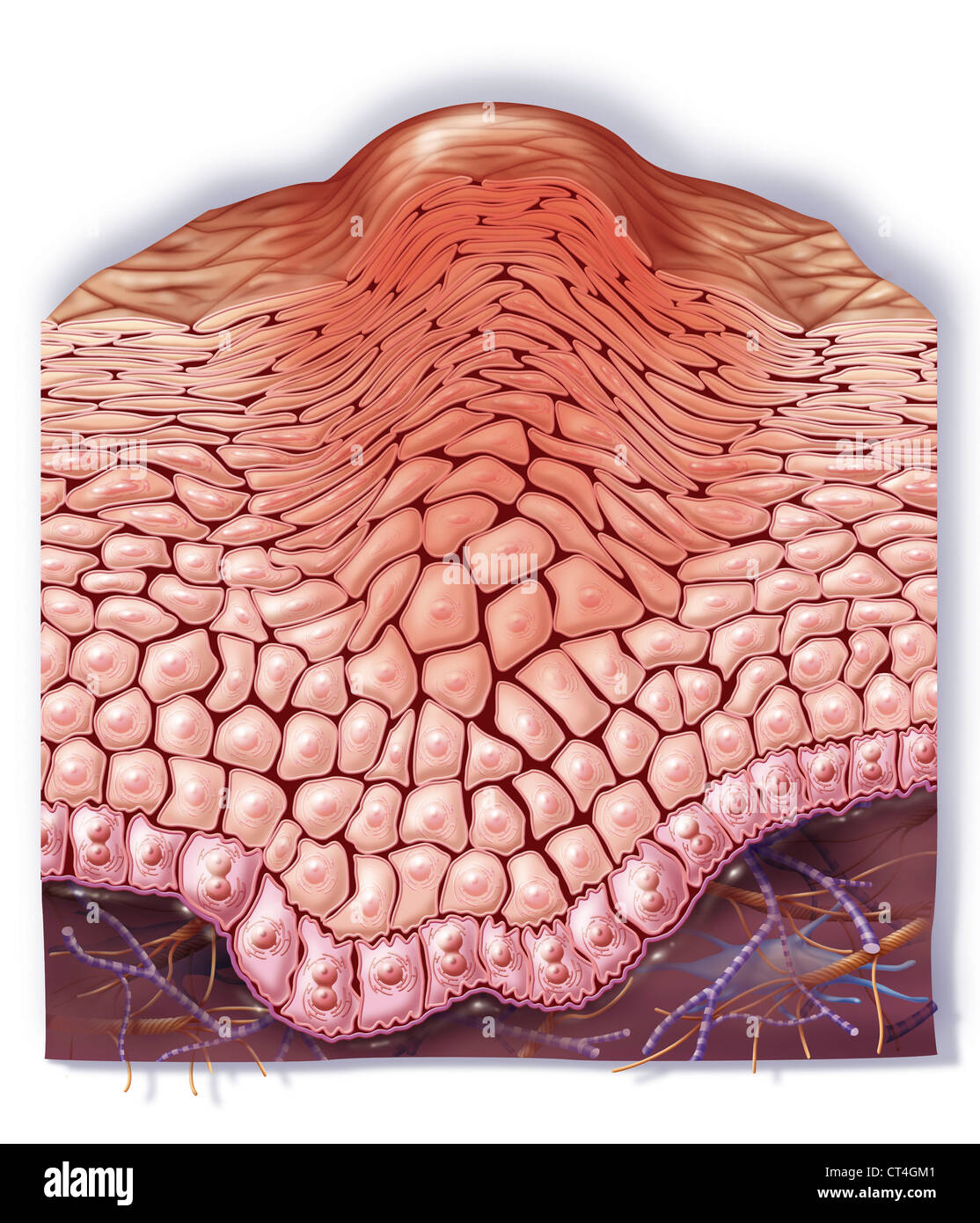 Warts Human Banque d'image et photos - Page 2 - Alamy