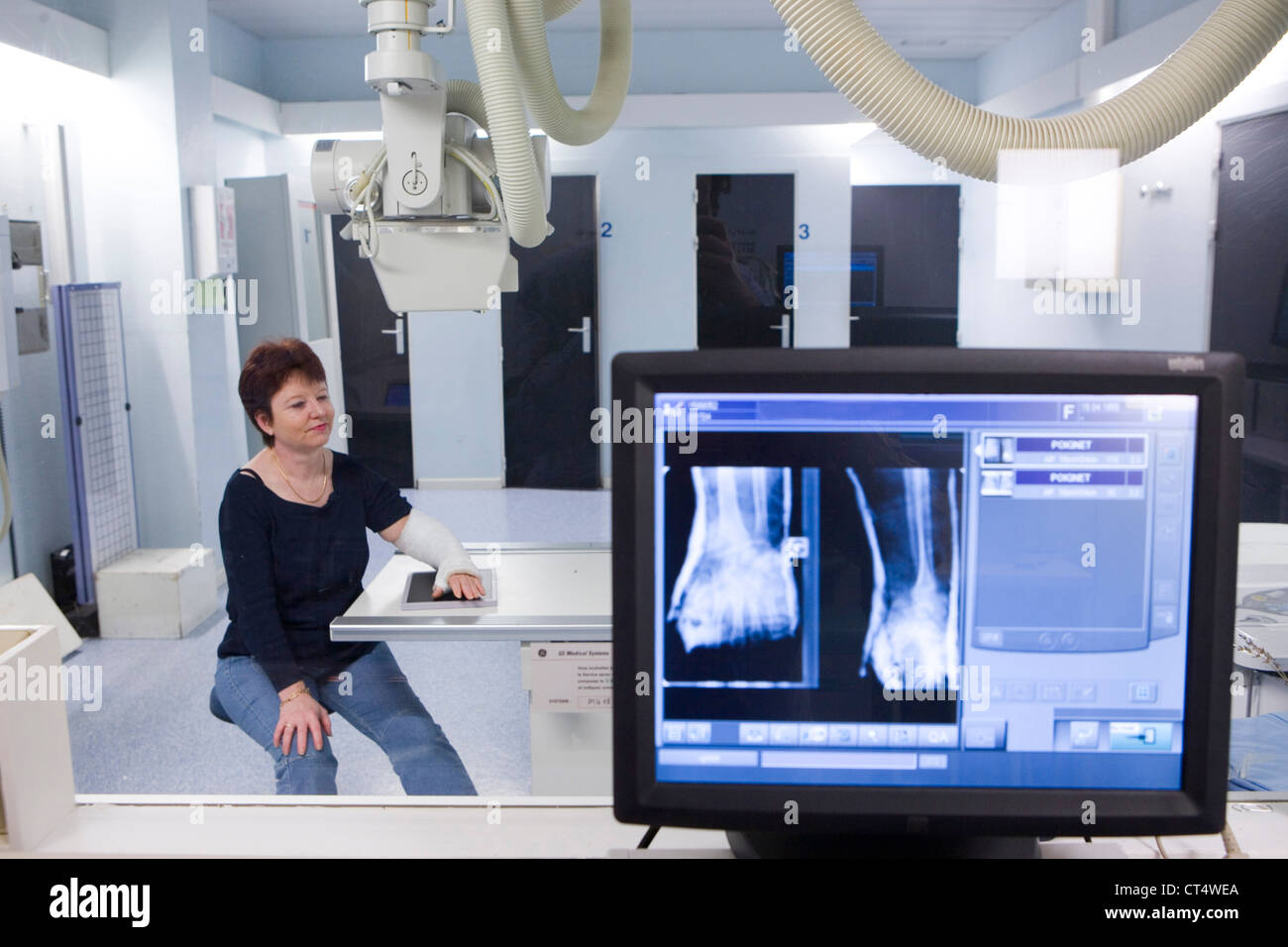 Radiographie du bras Banque de photographies et d’images à haute ...