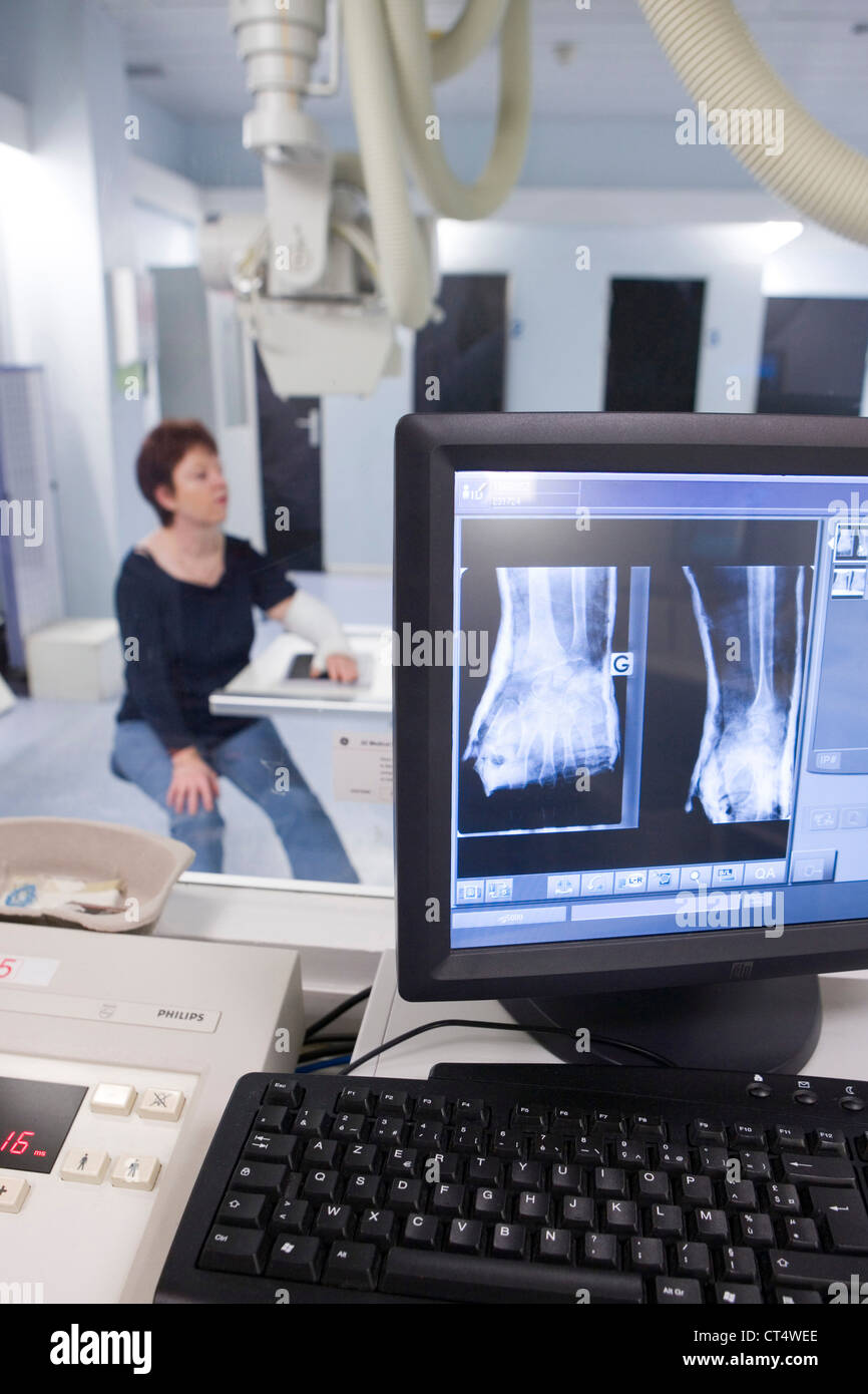 Radiographie du bras Banque de photographies et d’images à haute ...
