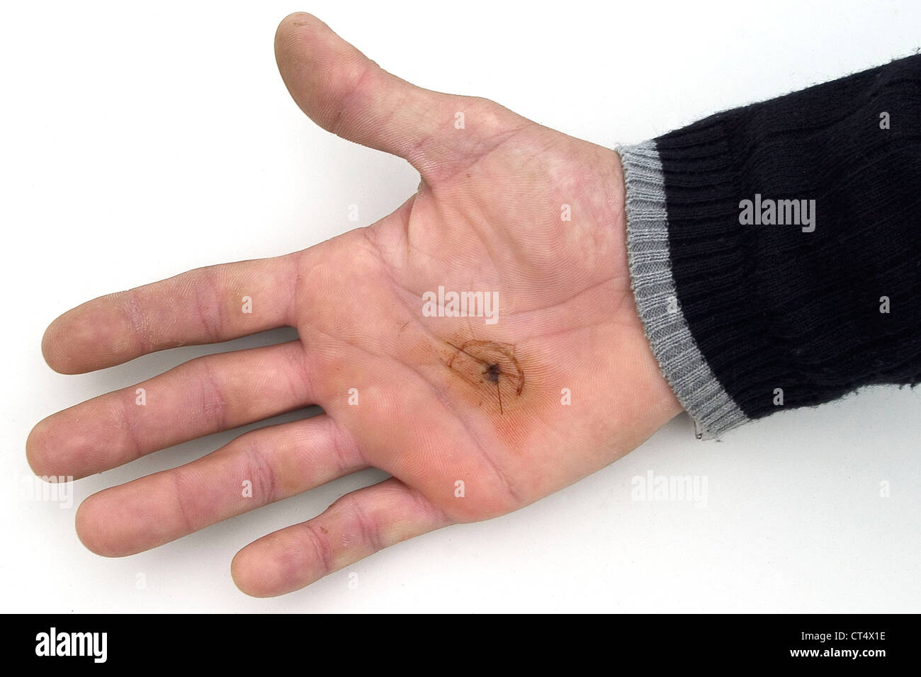 Accident hand drill Banque de photographies et d’images à haute ...