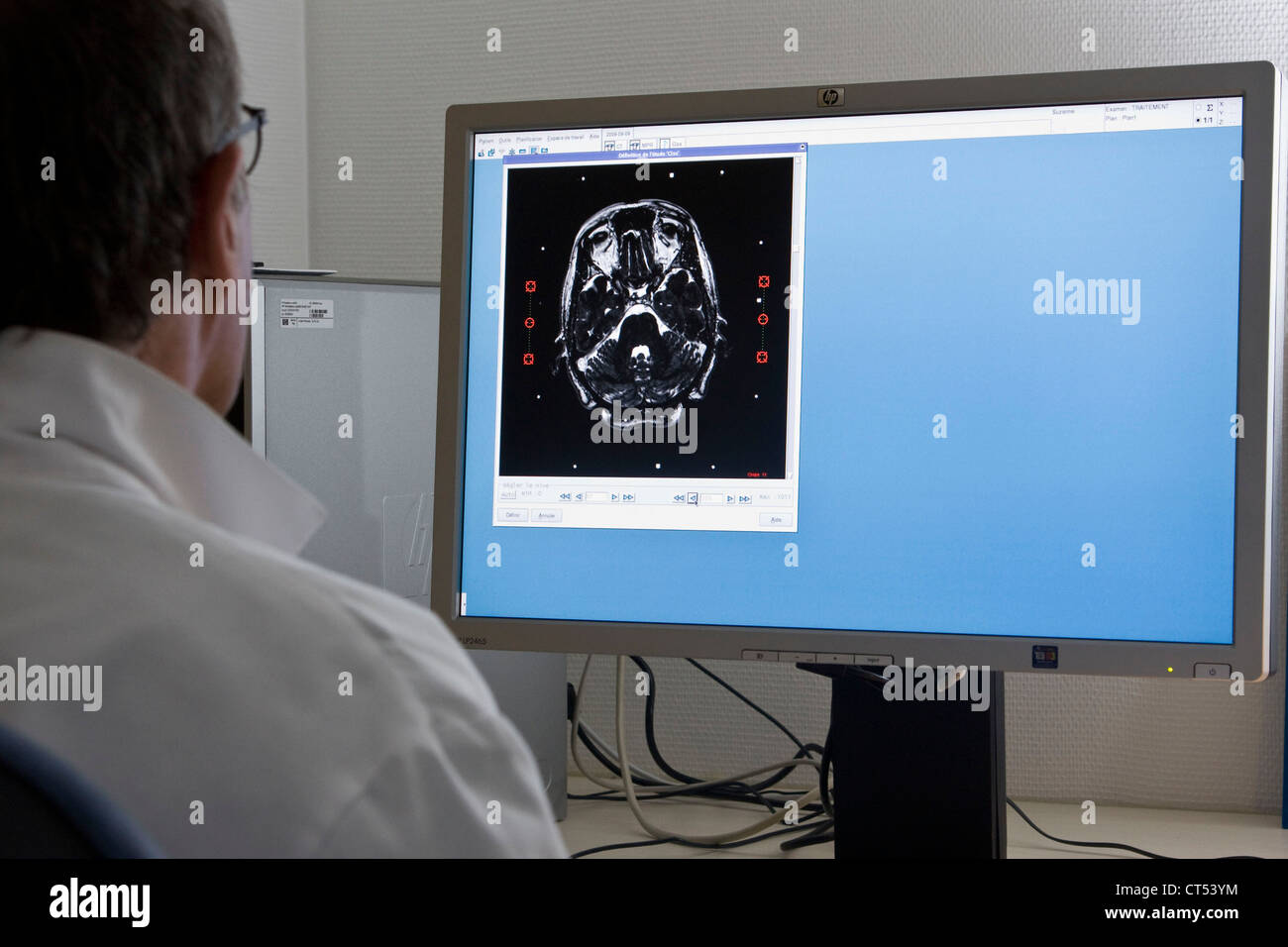 Examen de los nervios craneales Banque de photographies et d’images à ...