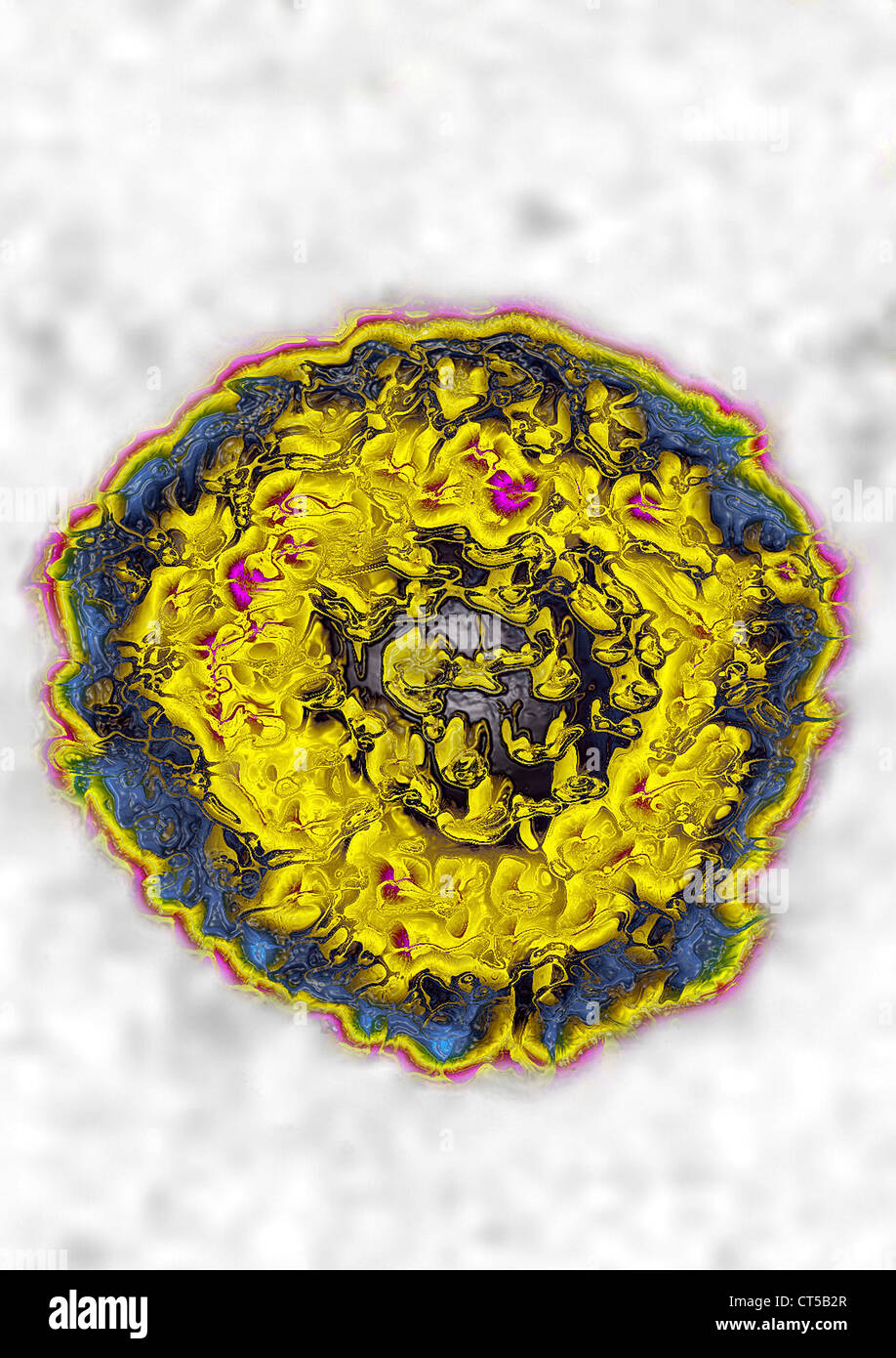 Virus de la rubéole Banque de photographies et d’images à haute ...