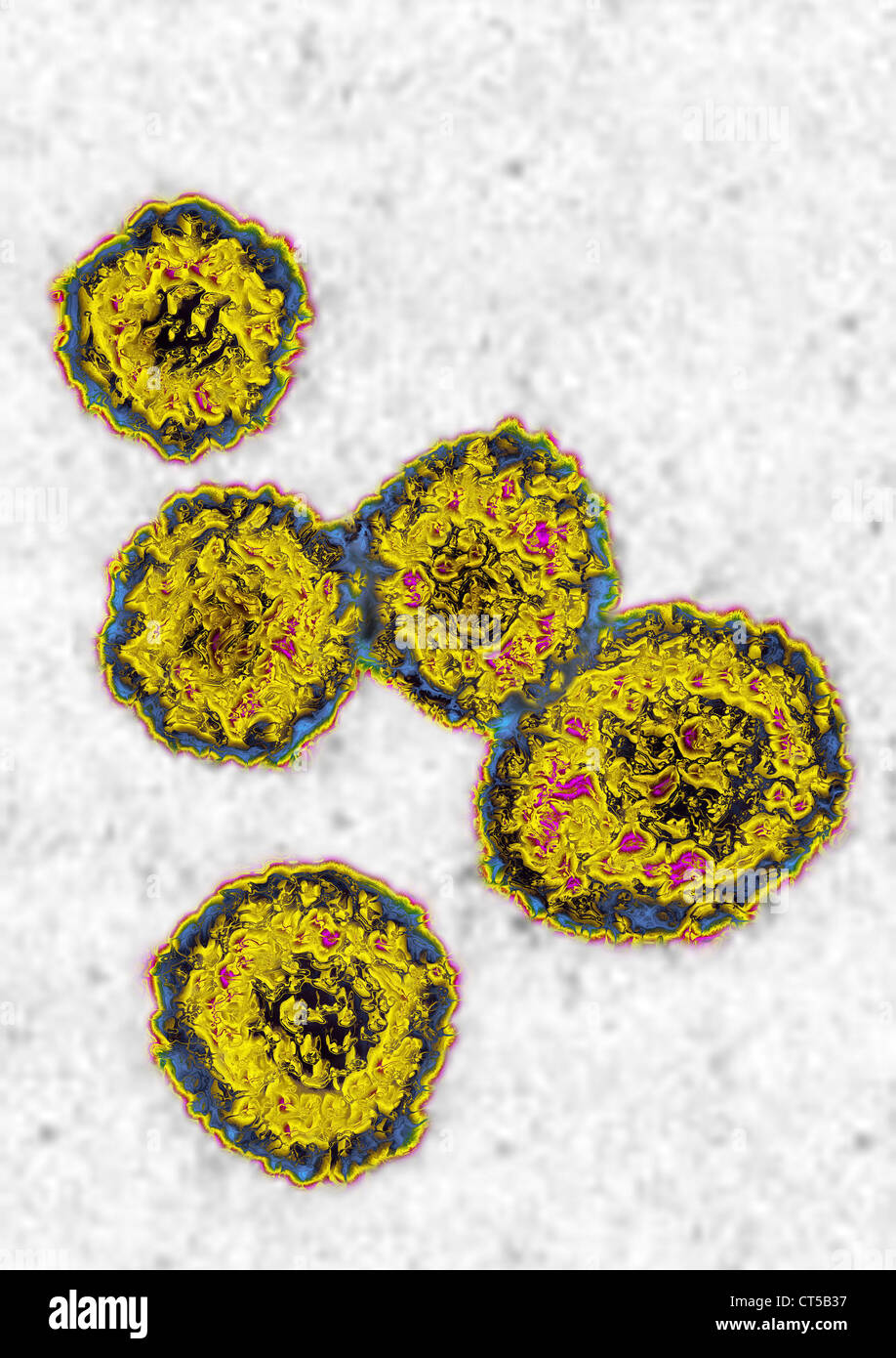 Virus de la rougeole, illustration Banque de photographies et d’images ...