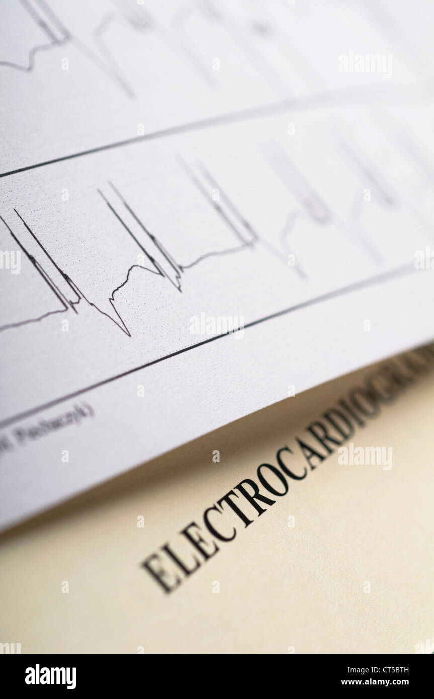 Trace cardiaque ecg Banque de photographies et d’images à haute ...