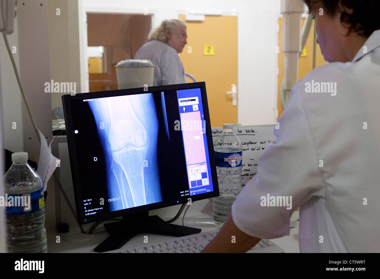 Radiographie de la jambe au genou Banque de photographies et d’images à ...