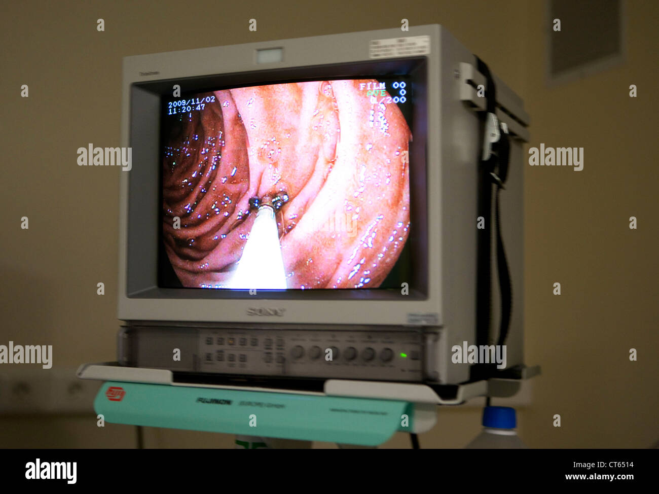 Test De Biopsie Banque d'image et photos - Alamy