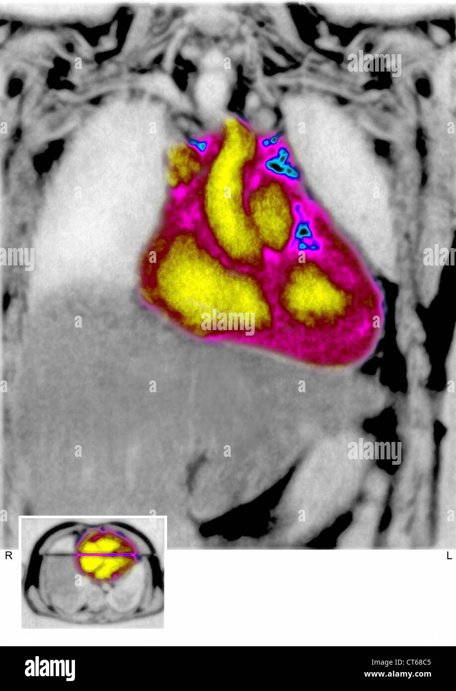 Irm cardiaque Banque de photographies et d’images à haute résolution ...