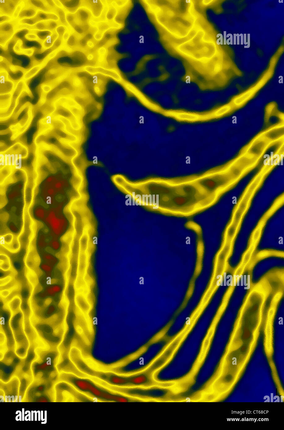 Vascularisation renal Banque de photographies et d’images à haute ...