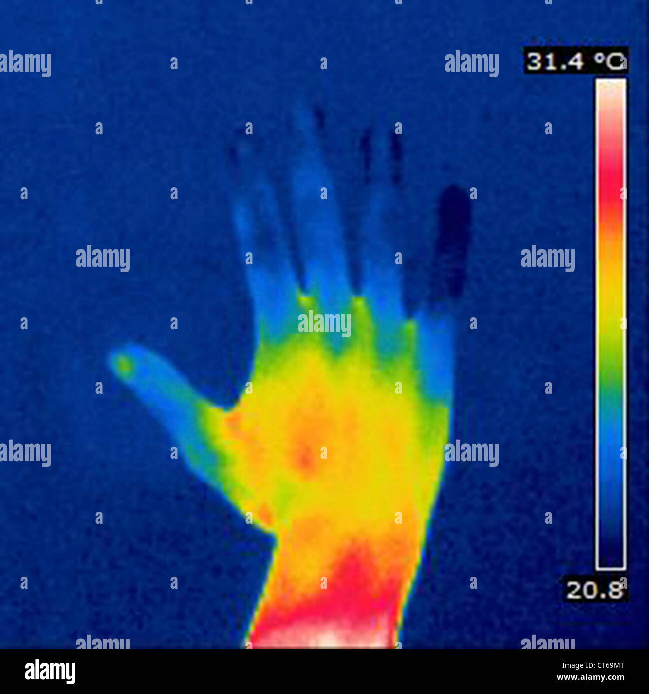 Thermogramme humain Banque de photographies et d’images à haute ...