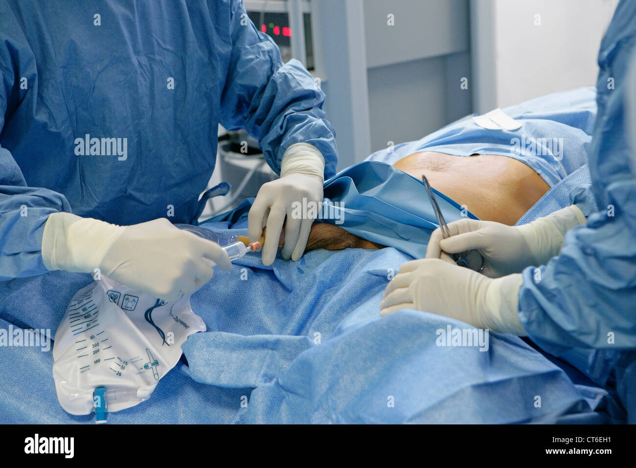 La chirurgie de la PROSTATE Photo Stock - Alamy