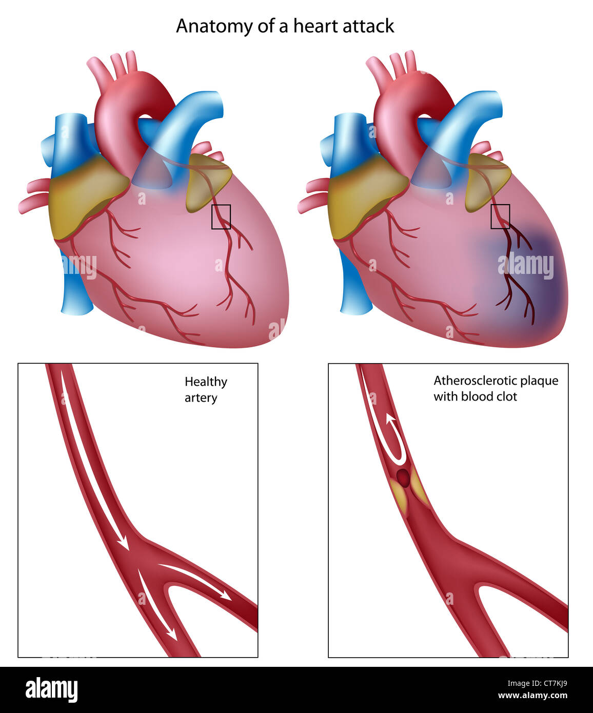 Anatomie cardiaque et vaisseaux sanguins Banque d'images détourées ...