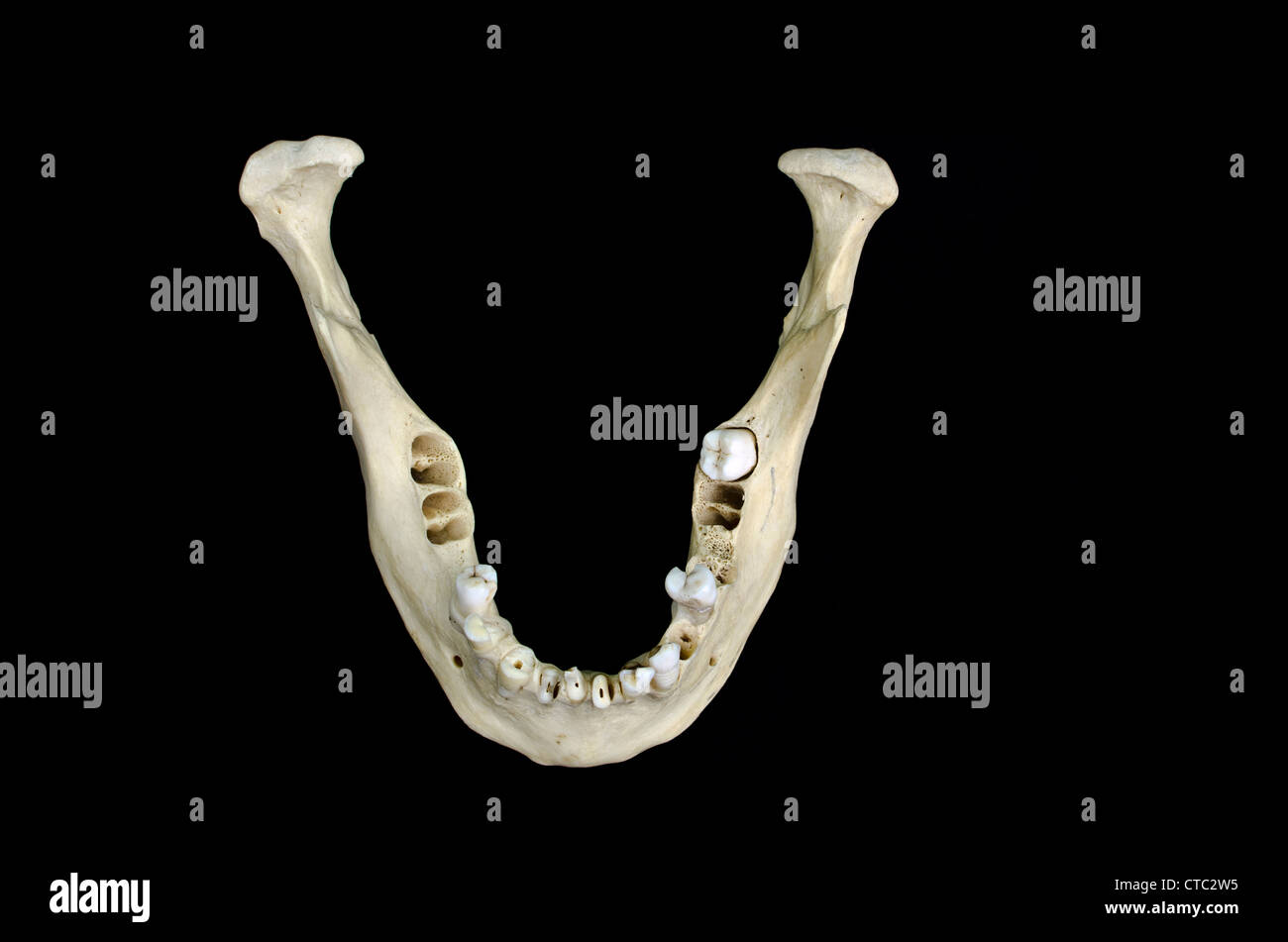 Mâchoire Humaine Banque d'image et photos - Alamy