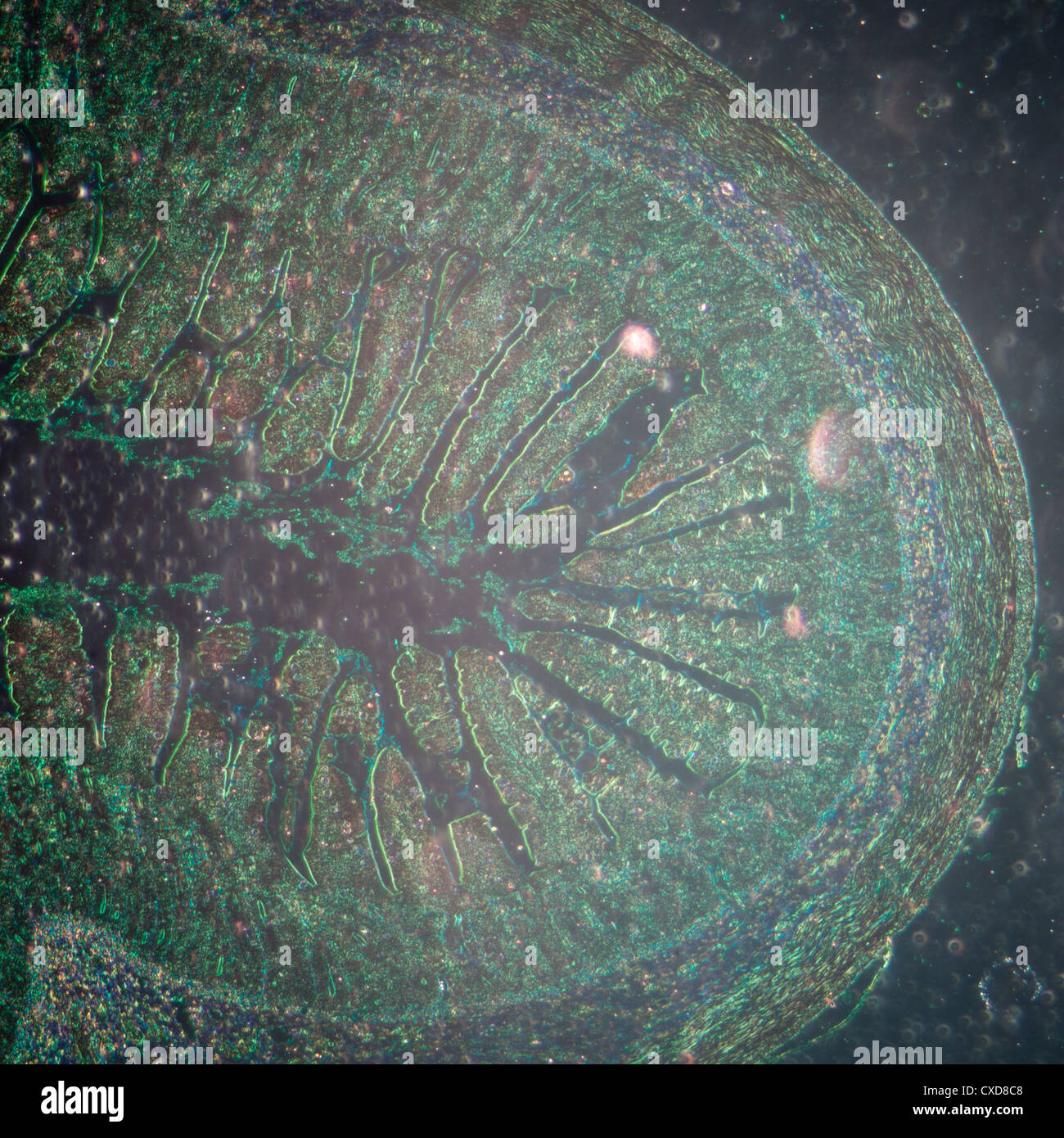 Intestinum tenue Banque de photographies et d’images à haute résolution ...