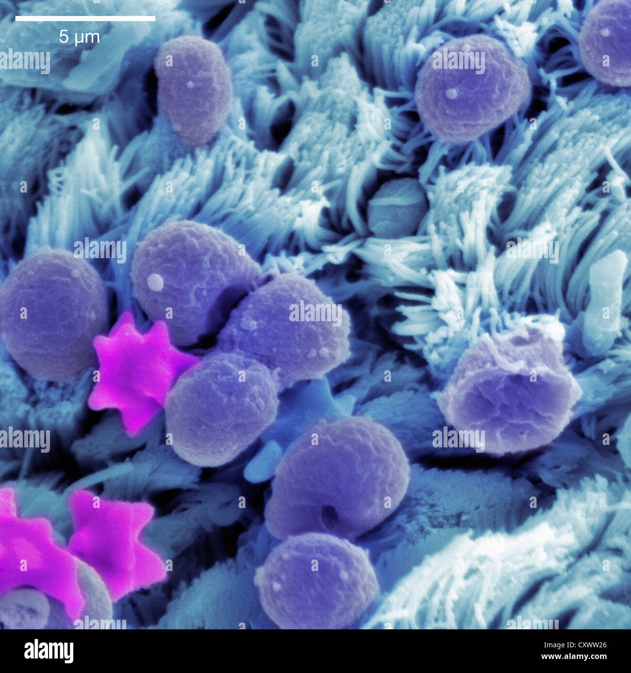 Micrograph Blood Cells Banque d'image et photos - Alamy