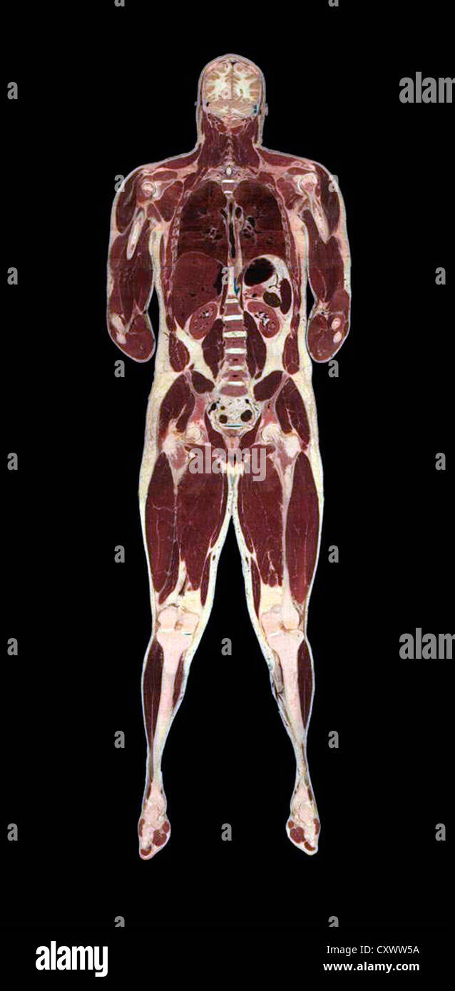 Corps humain anatomie Banque de photographies et d’images à haute ...