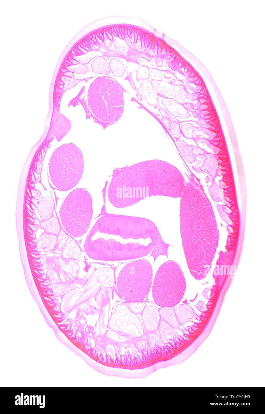Ascaris lumbricoides Banque de photographies et d’images à haute ...