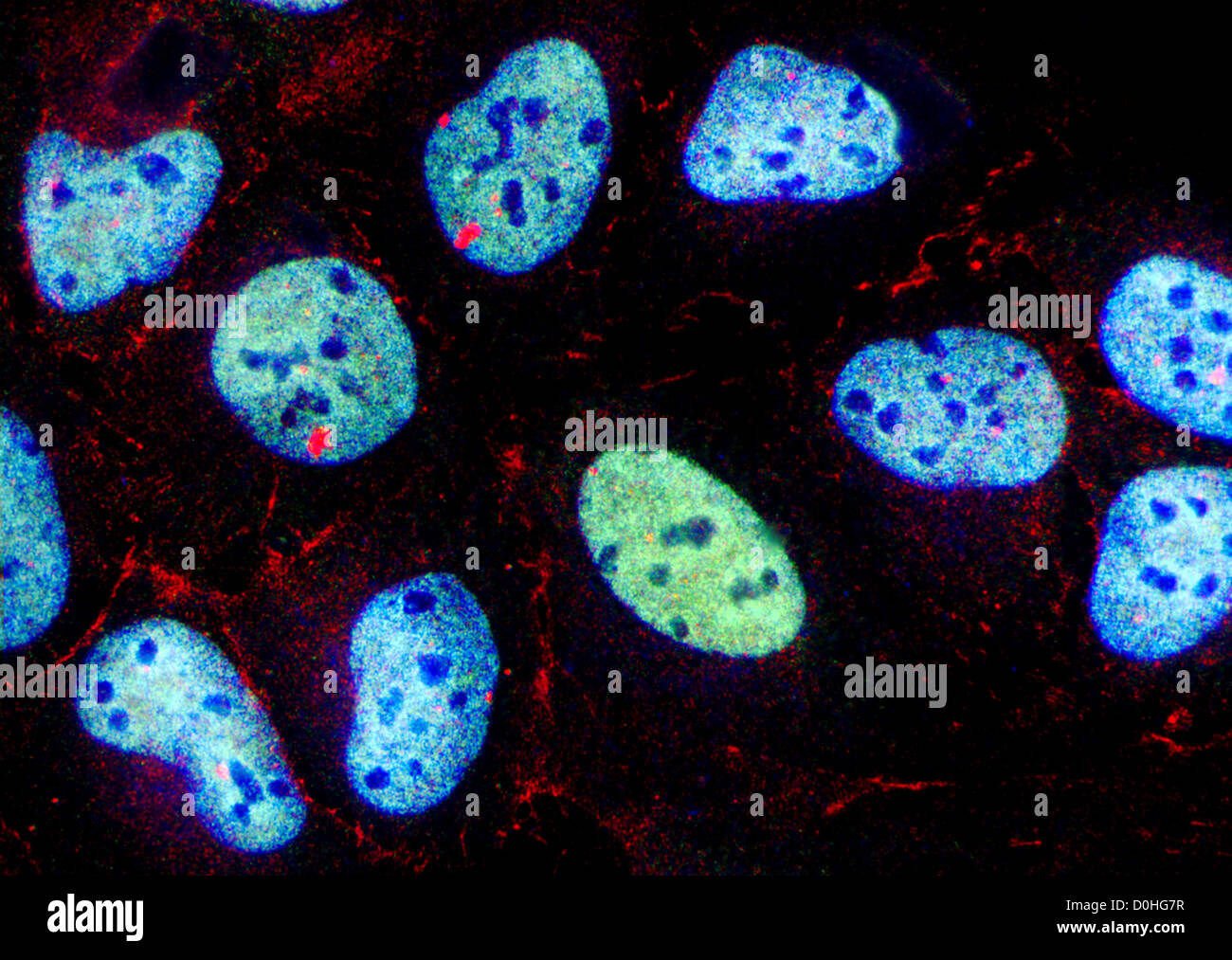Ribosome micrographie Banque de photographies et d’images à haute ...