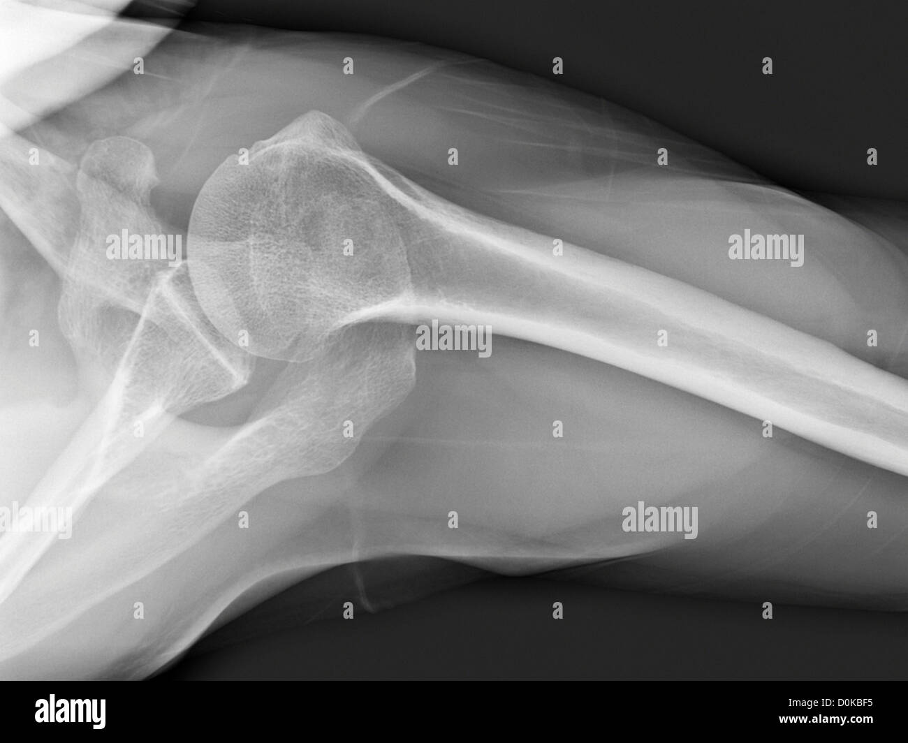 Radiografia de un cuerpo humano Banque d'images noir et blanc - Alamy