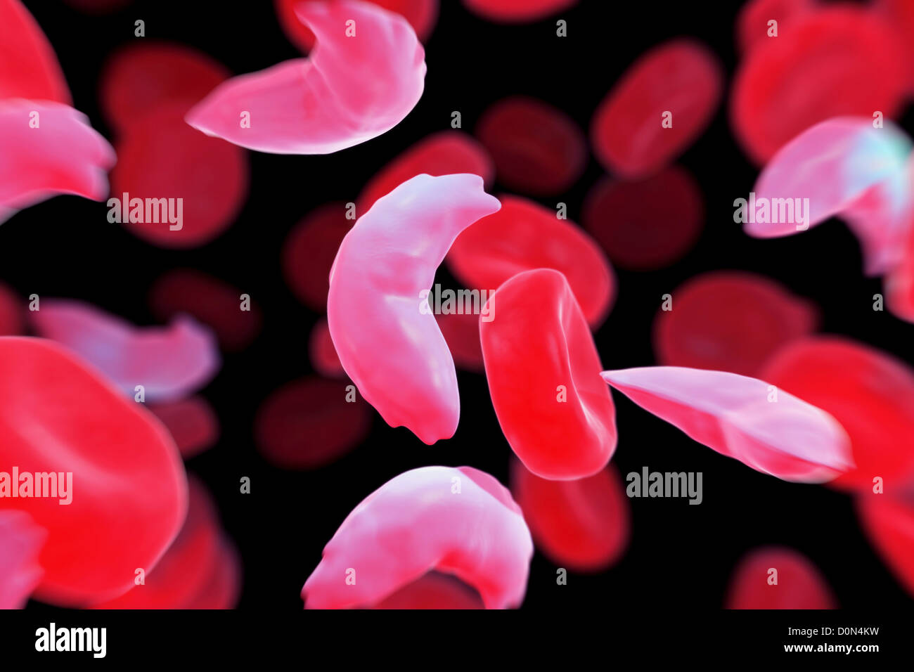 La drépanocytose la drépanocytose la drépanocytose ou trouble sanguin ...