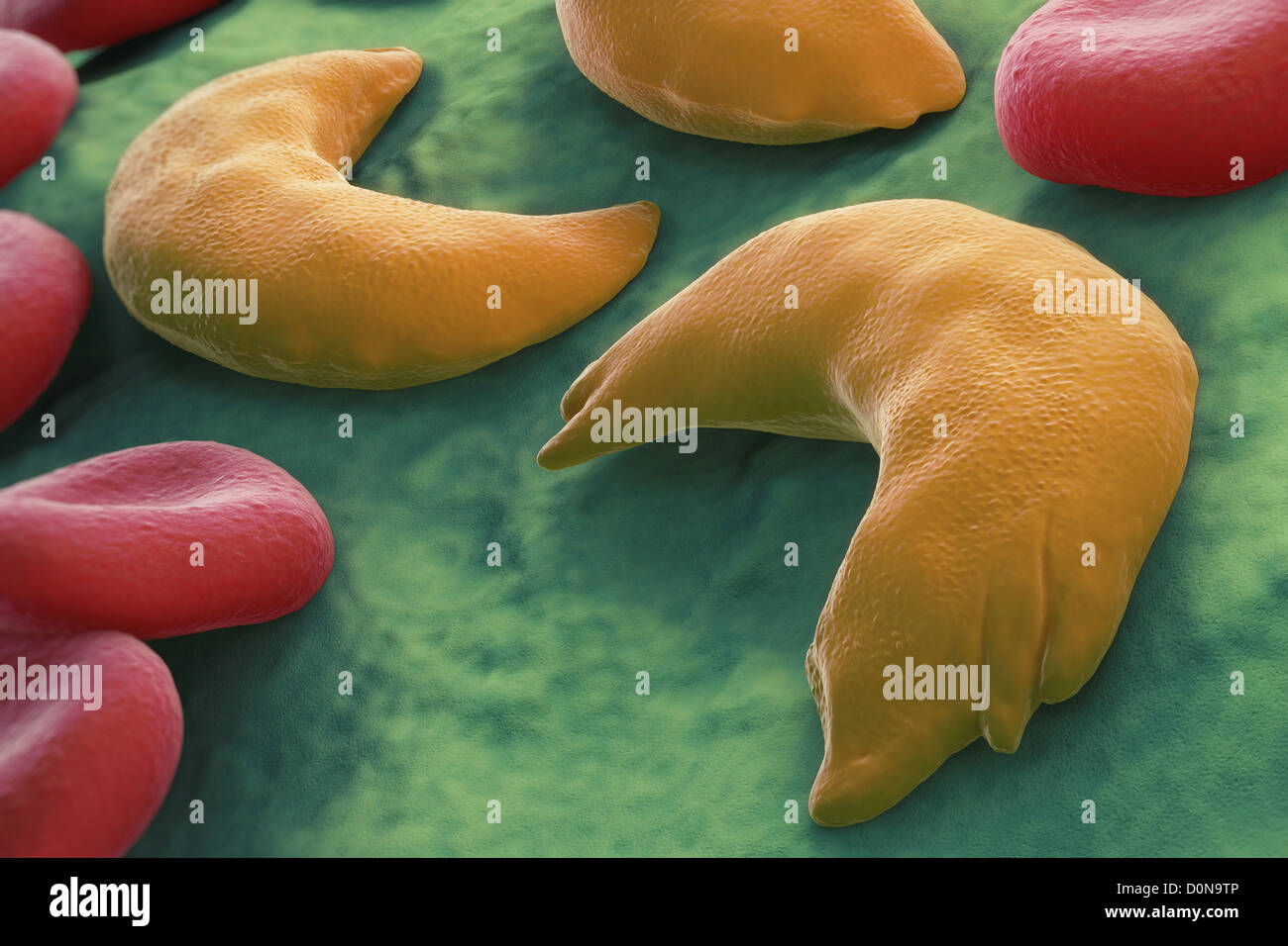 La drépanocytose la drépanocytose la drépanocytose ou trouble sanguin ...