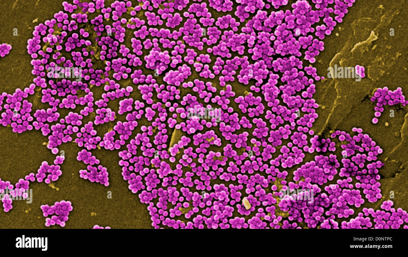 Microphotograph Of Gram Positive Staphylococcus Aureus In