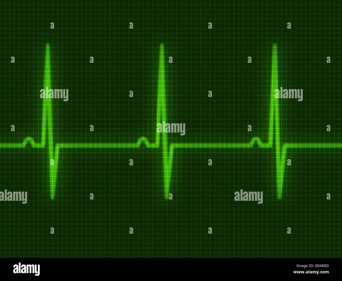 Cardiogramme cardiaque Banque de photographies et d’images à haute ...