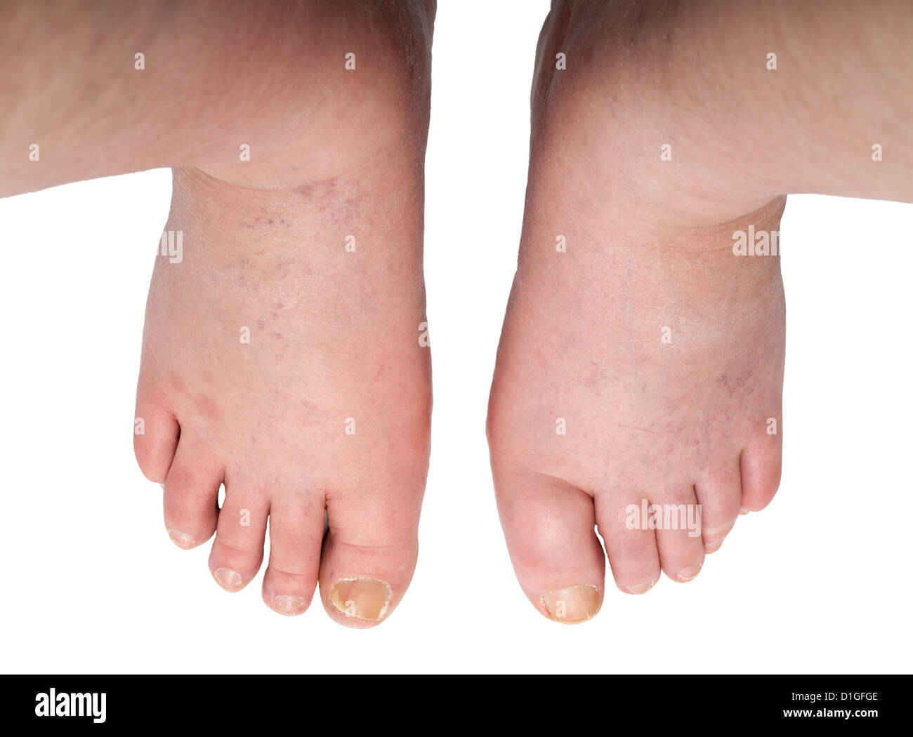 Fungal flesh Banque de photographies et d’images à haute résolution - Alamy