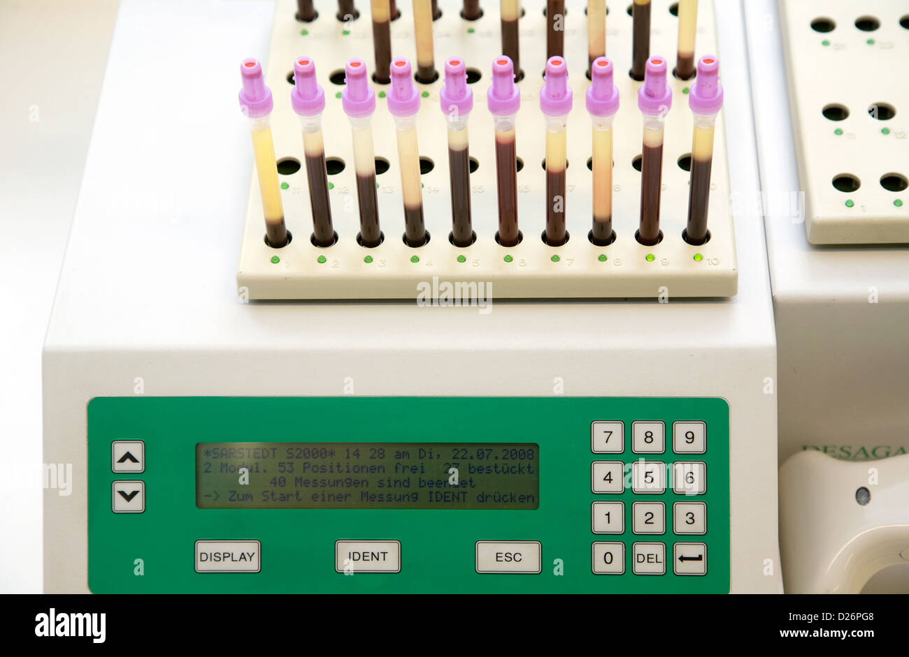 Essen, Allemagne, la mesure de la vitesse de sédimentation des ...